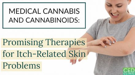 Cannabinoids in Dermatology: Benefits for Skin Conditions