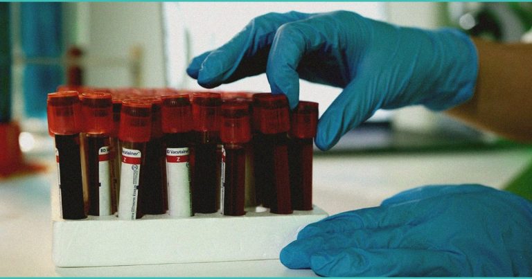 Cannabidiol Oil Psoriasis Safety: Clinical Trial Insights